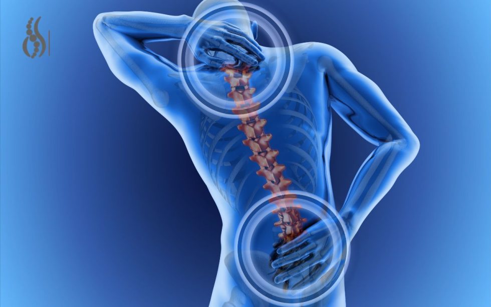 Lower Back Pain: Understanding Low Back Pain, Symptoms, Diagnosis, and ...